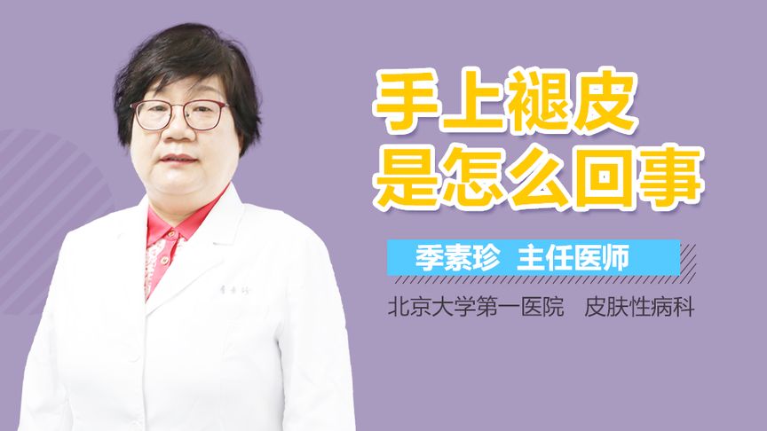 为什么手上会褪皮?大多是这几个因素引起的#健康知多少#