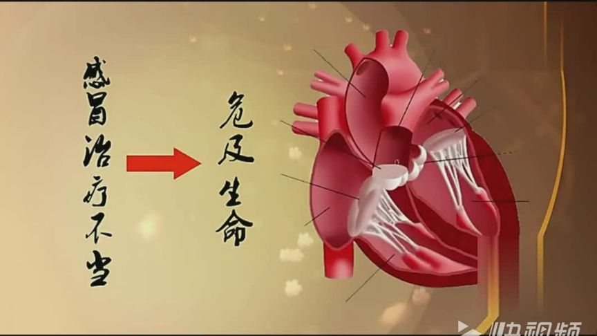 可怕!感冒竟然能诱发心脏病致猝死