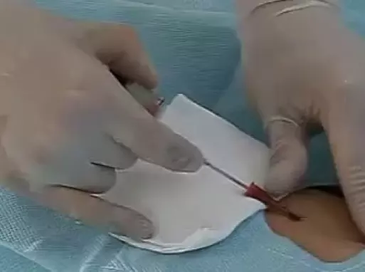 picc操作视频