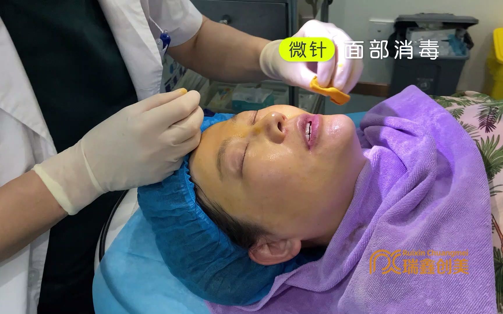 针对皮肤祛黄的微针治疗!