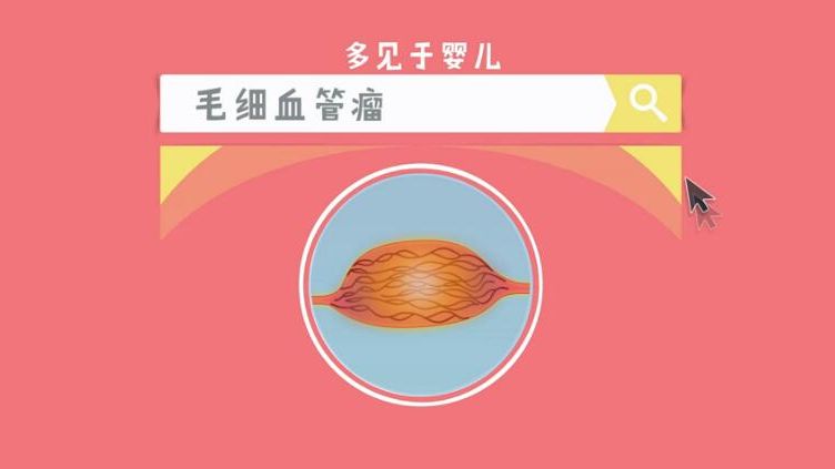 血管瘤是怎么回事?血管瘤的治疗方法有哪些?