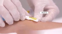我在安全型外周静脉留置针穿刺操作流程截了一段小视频