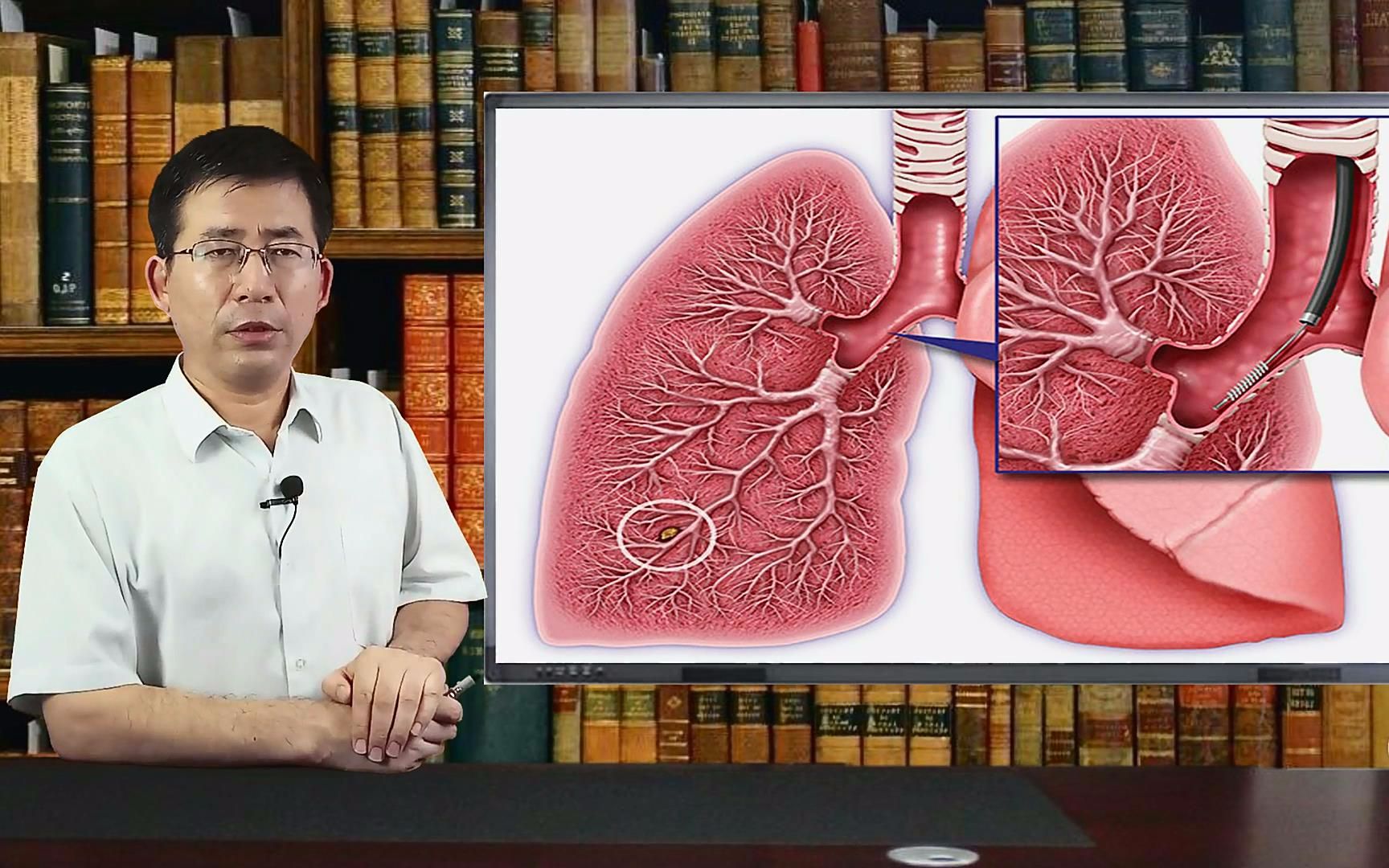 肺癌必不可少的检查:支气管镜检查(乐喷网出品)