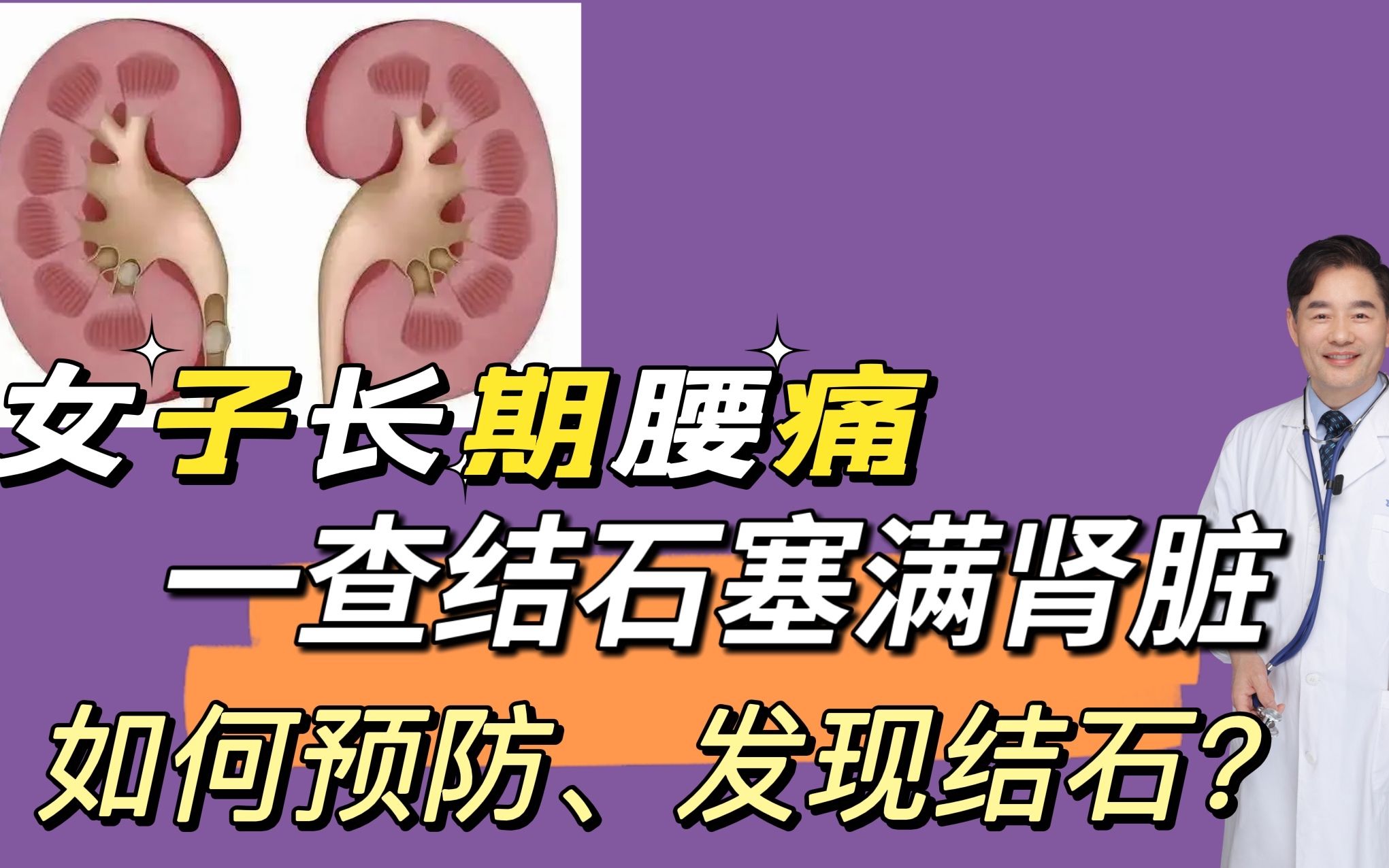 女子长期腰痛,一查结石塞满肾脏,如何预防和发现结石?