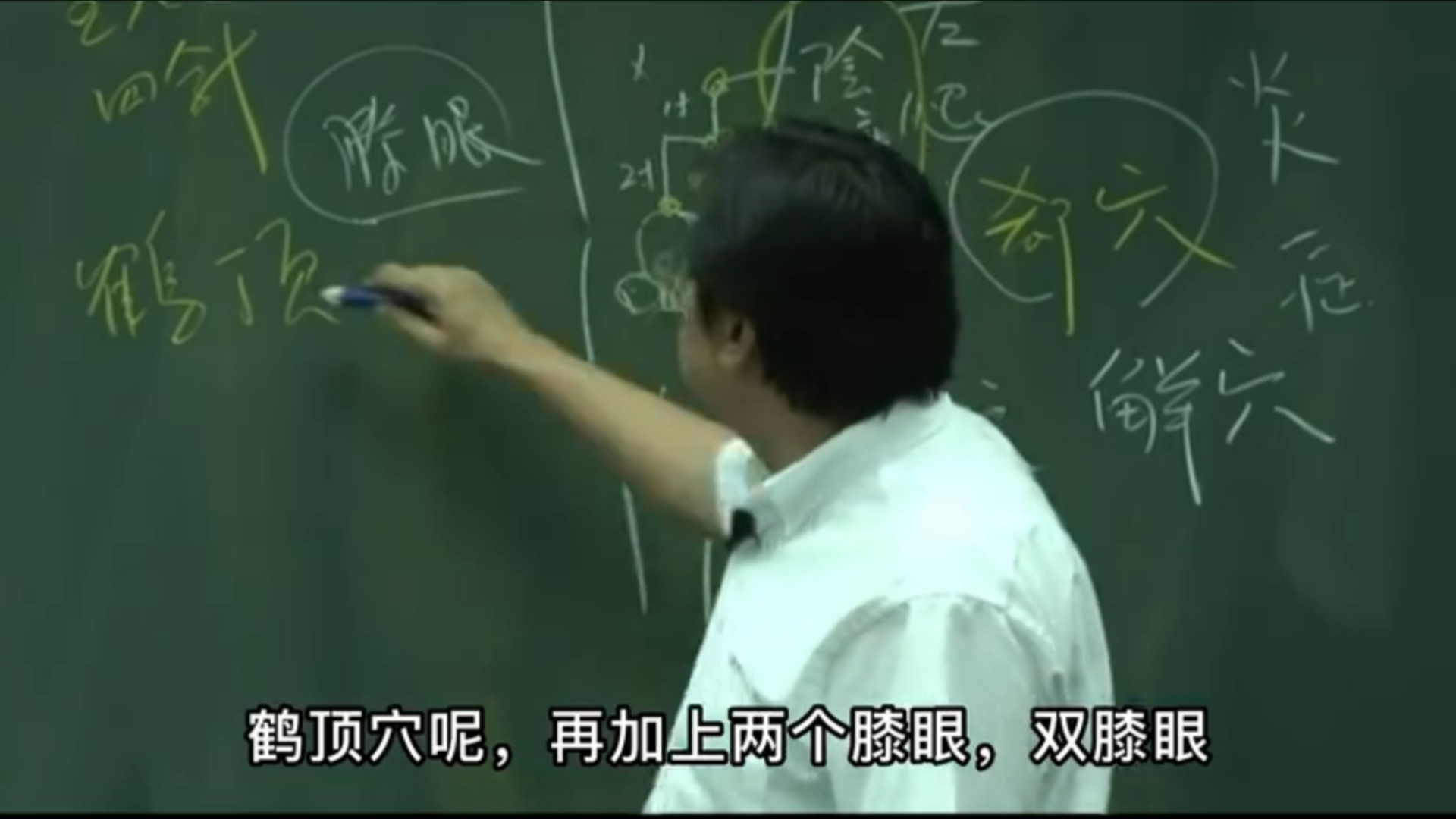 人纪针灸大成131:膝眼穴(经外奇穴)。五穴四针(膝眼穴+鹤顶穴+阳陵泉...