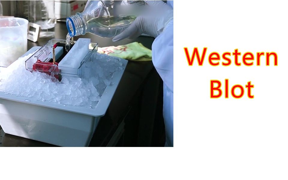【实验】Western Blot,WESTERN印迹原理,敷抗体,曝光,垂直槽式湿转...