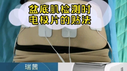 用盆底修复仪做盆底肌检测时电极片的贴法
