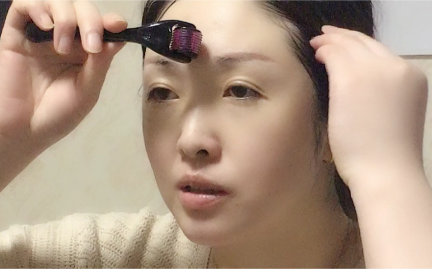 美容院微针项目详细操作流程,学会在家自己做,省时省钱,真方便