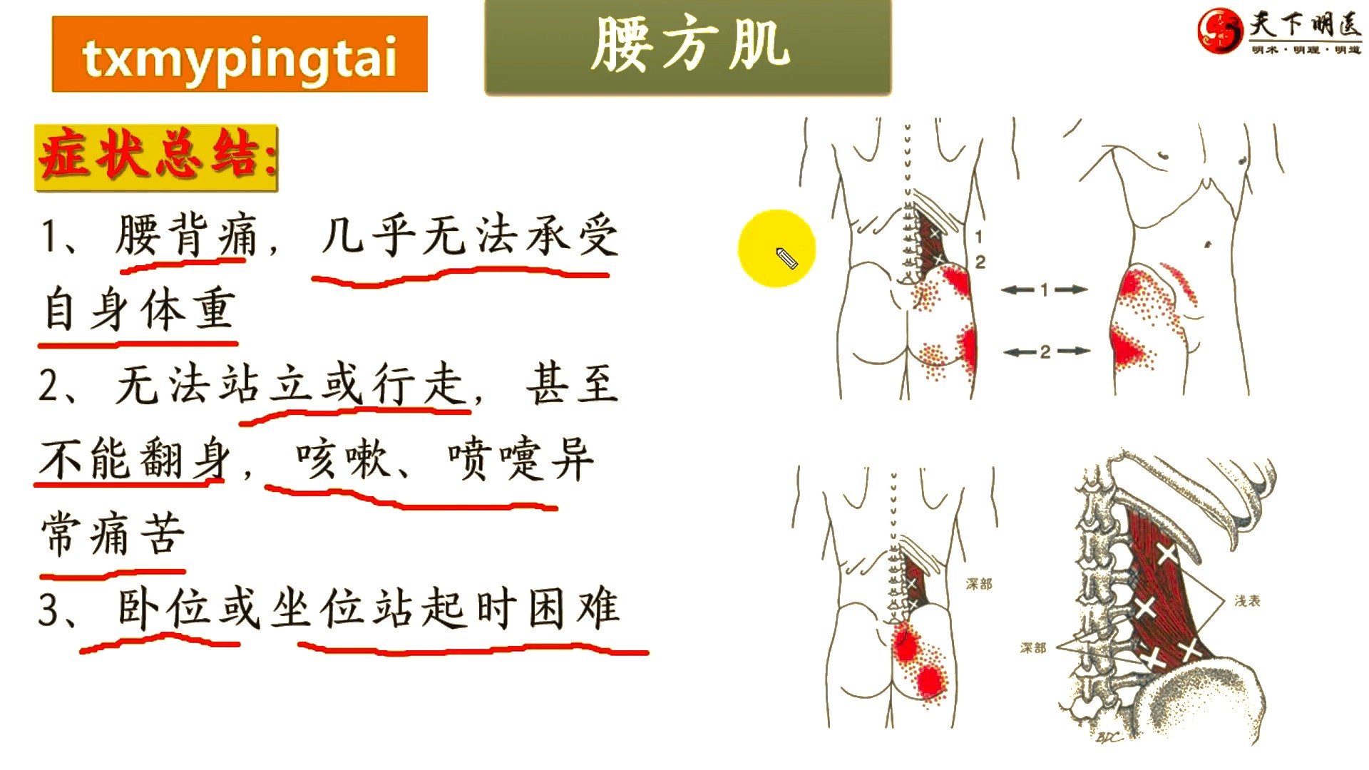 腰方肌的位置、腰方肌的功能、腰方肌的激痛点、腰方肌损伤后的症状...