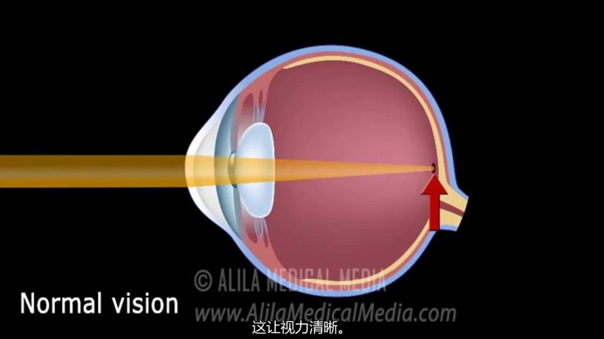 医学科普动画:2分钟告诉你眼球的结构和成像原理及近视远视成因