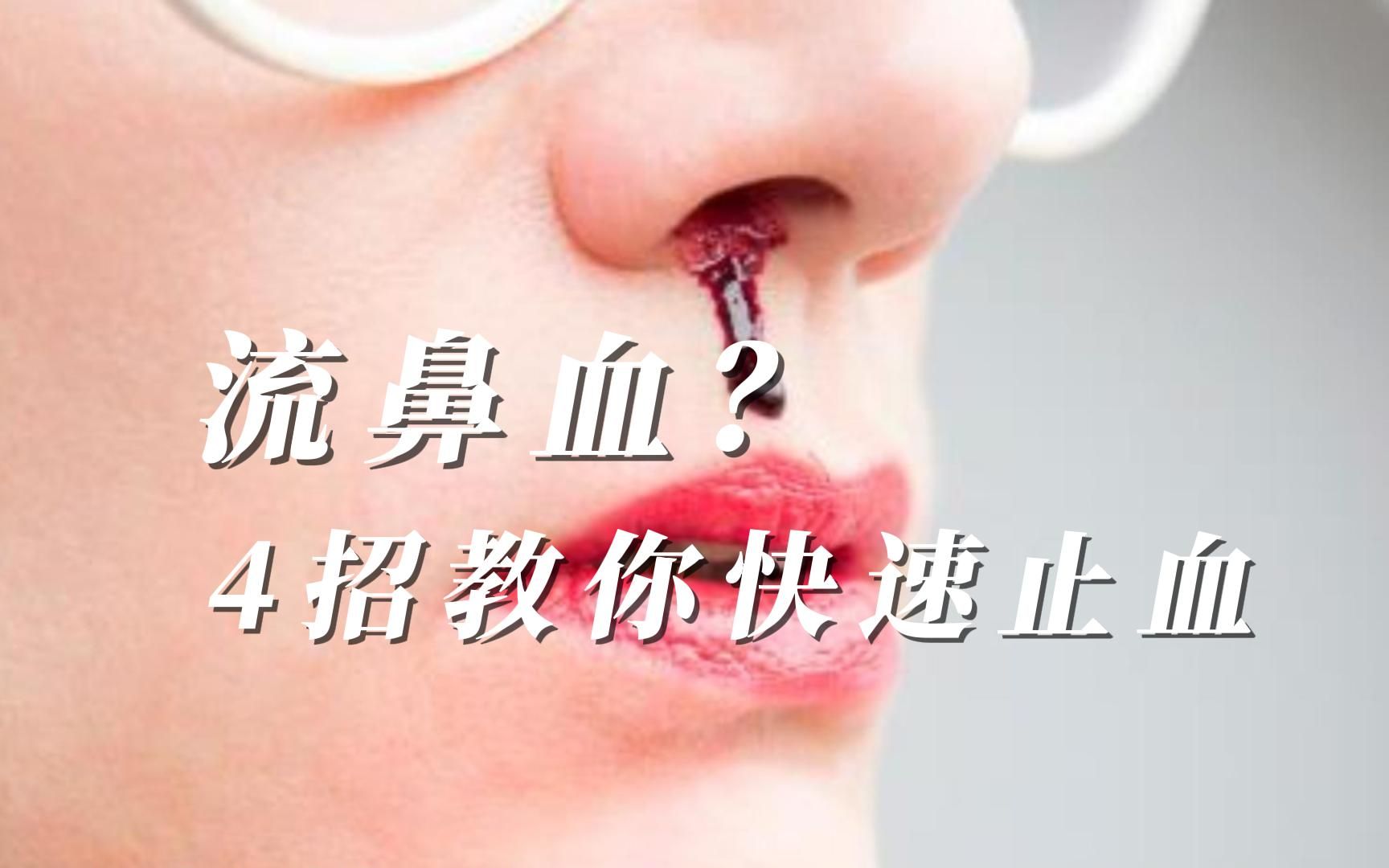 流鼻血?4招教你快速止血