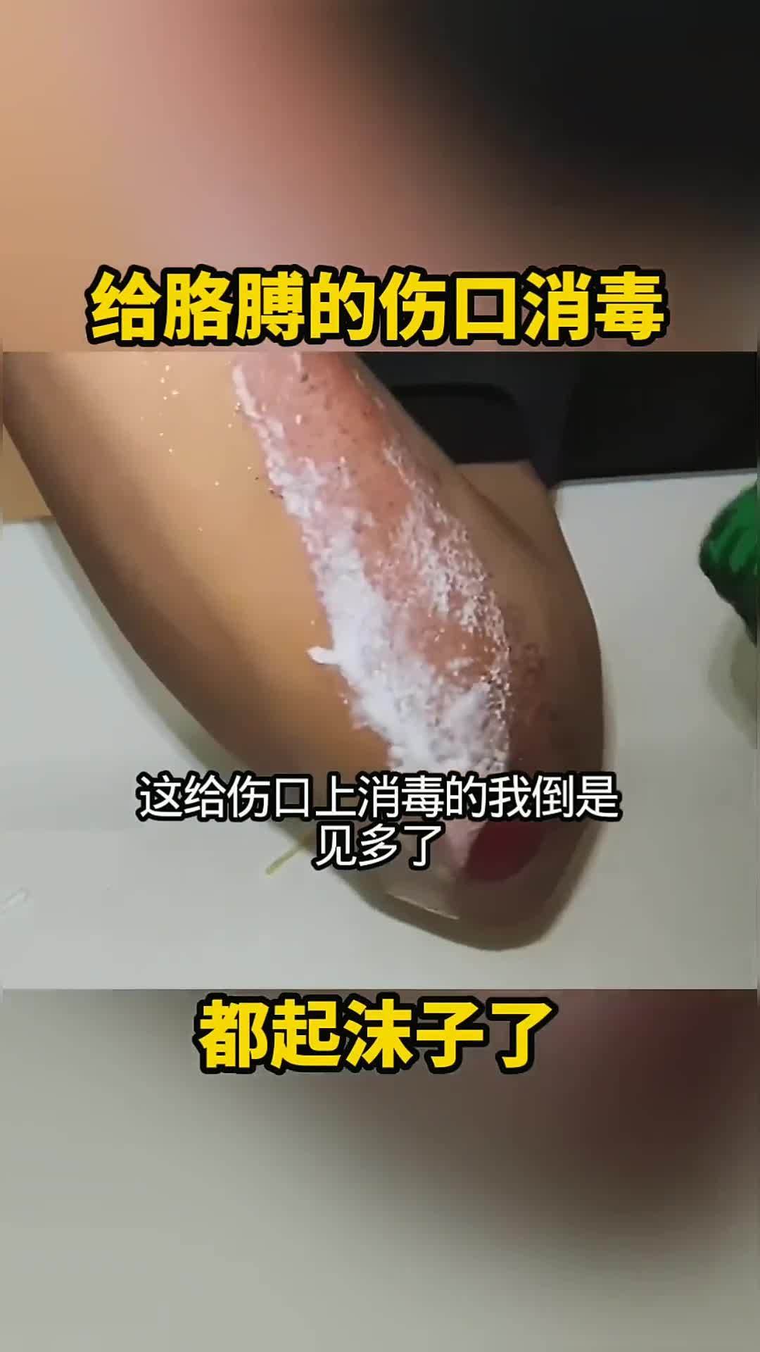 给胳膊的伤口消毒,都起沫子了