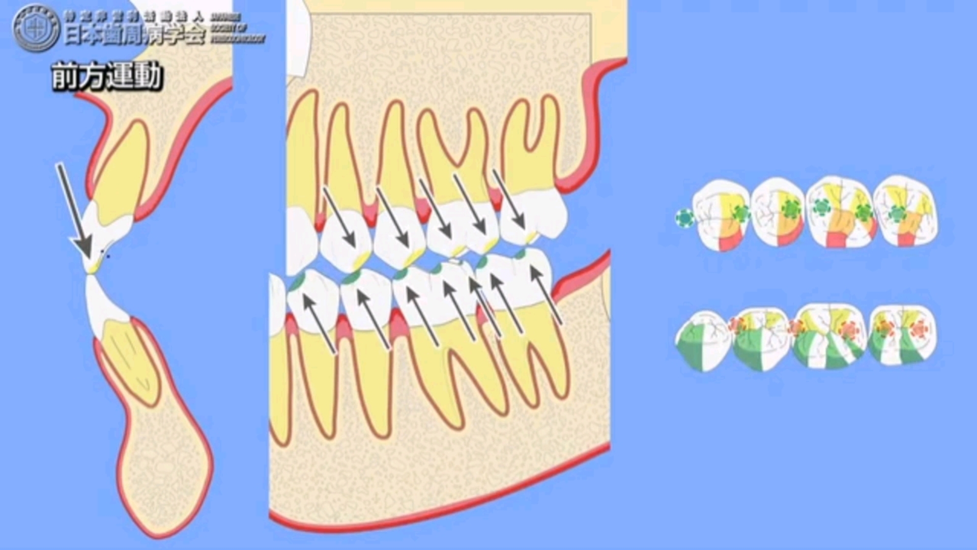 ଌ�学咬合-前伸ଌ
