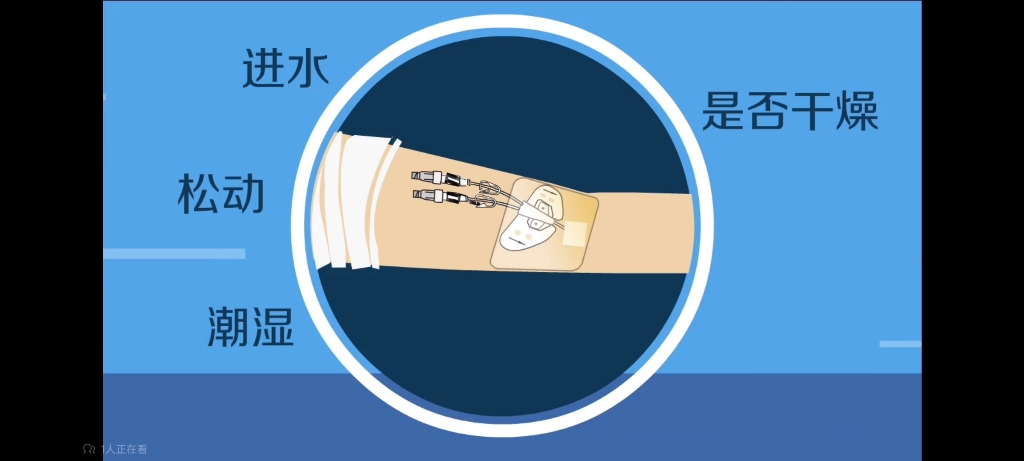 PICC置管护理