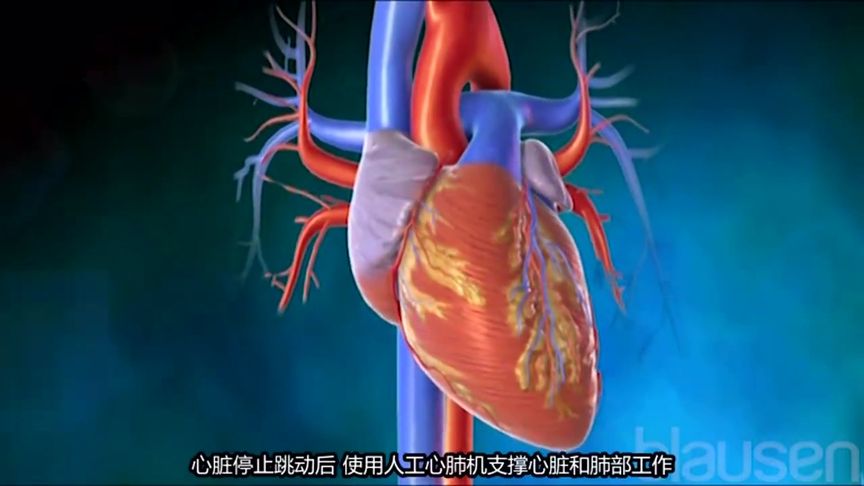 主动脉瓣置换术