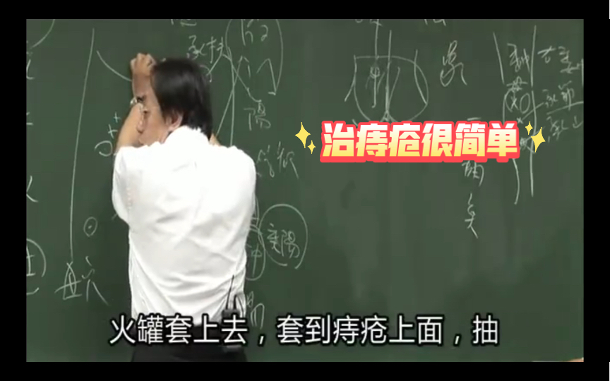 痔疮很好治,方法有很多,不用开刀