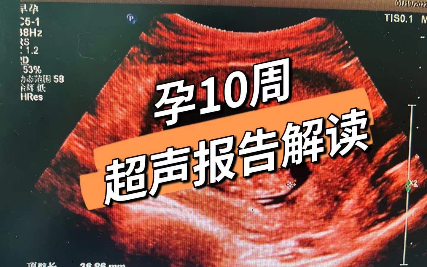 孕10周的超声报告解读
