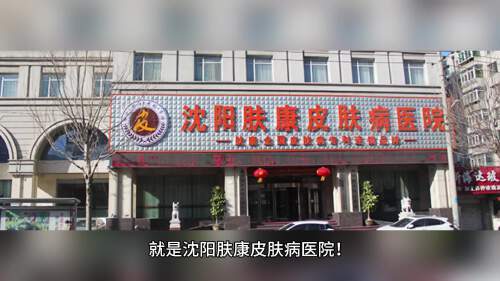 肌肤故障?别惊慌,沈阳肤康皮肤病医院是肌肤的特工