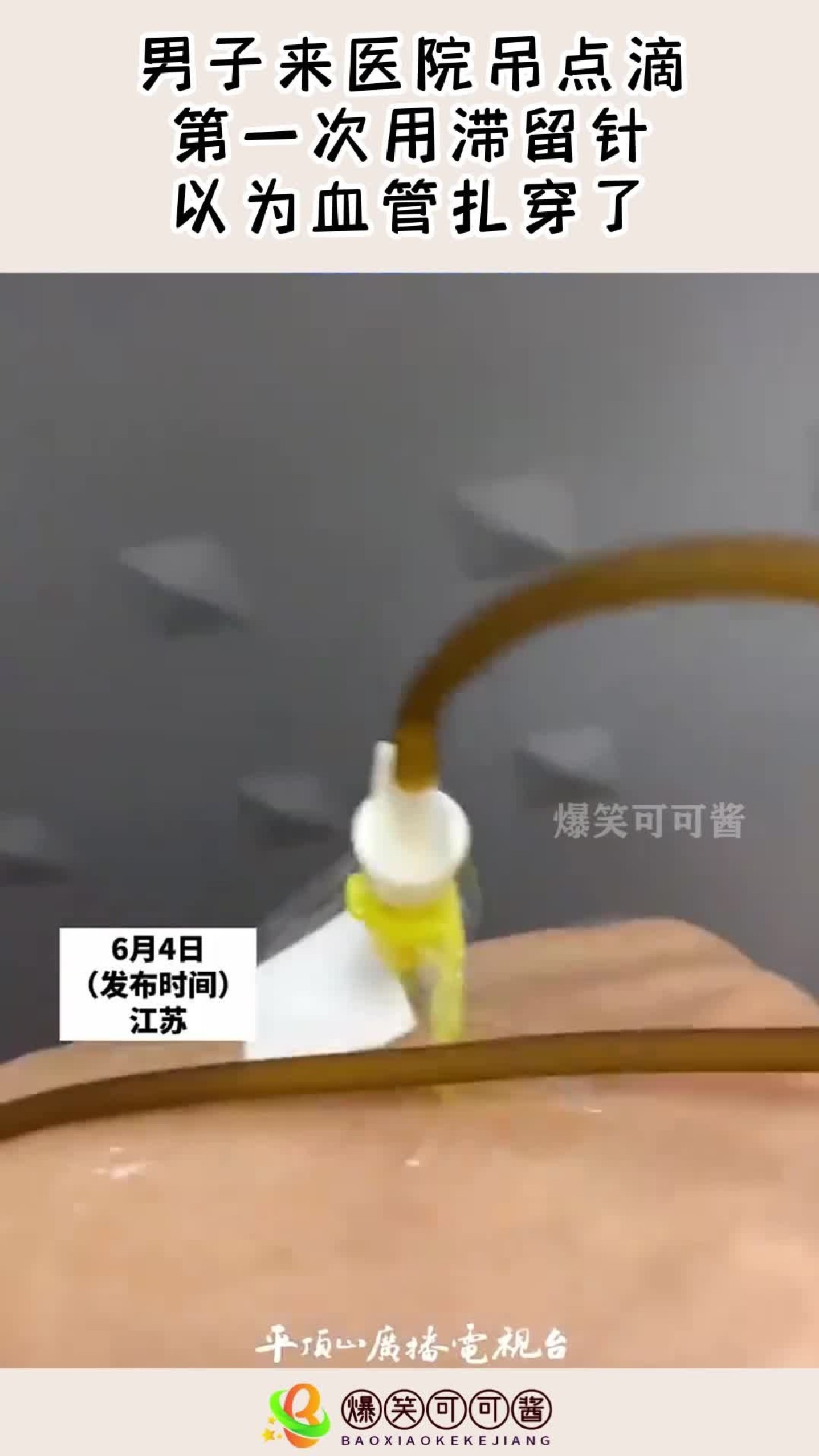 男子来医院吊点滴,第一次用滞留针,以为血管扎穿了