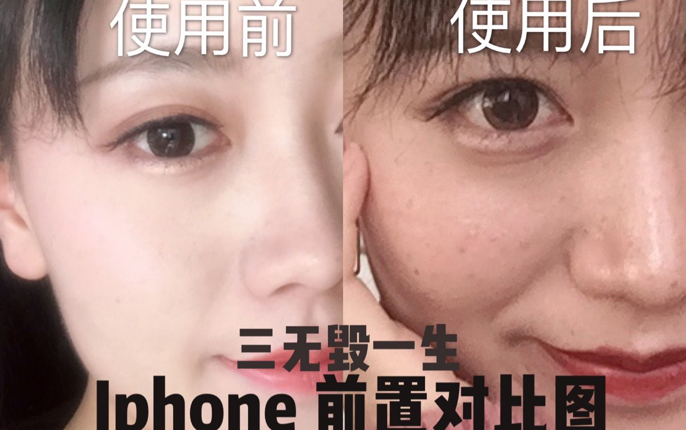 扒一扒三无微整精油:亲身毁脸经历