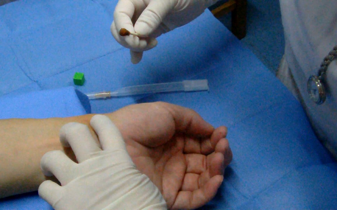 桡动脉血气采血演示-Radial Artery Blood Gas Sampling