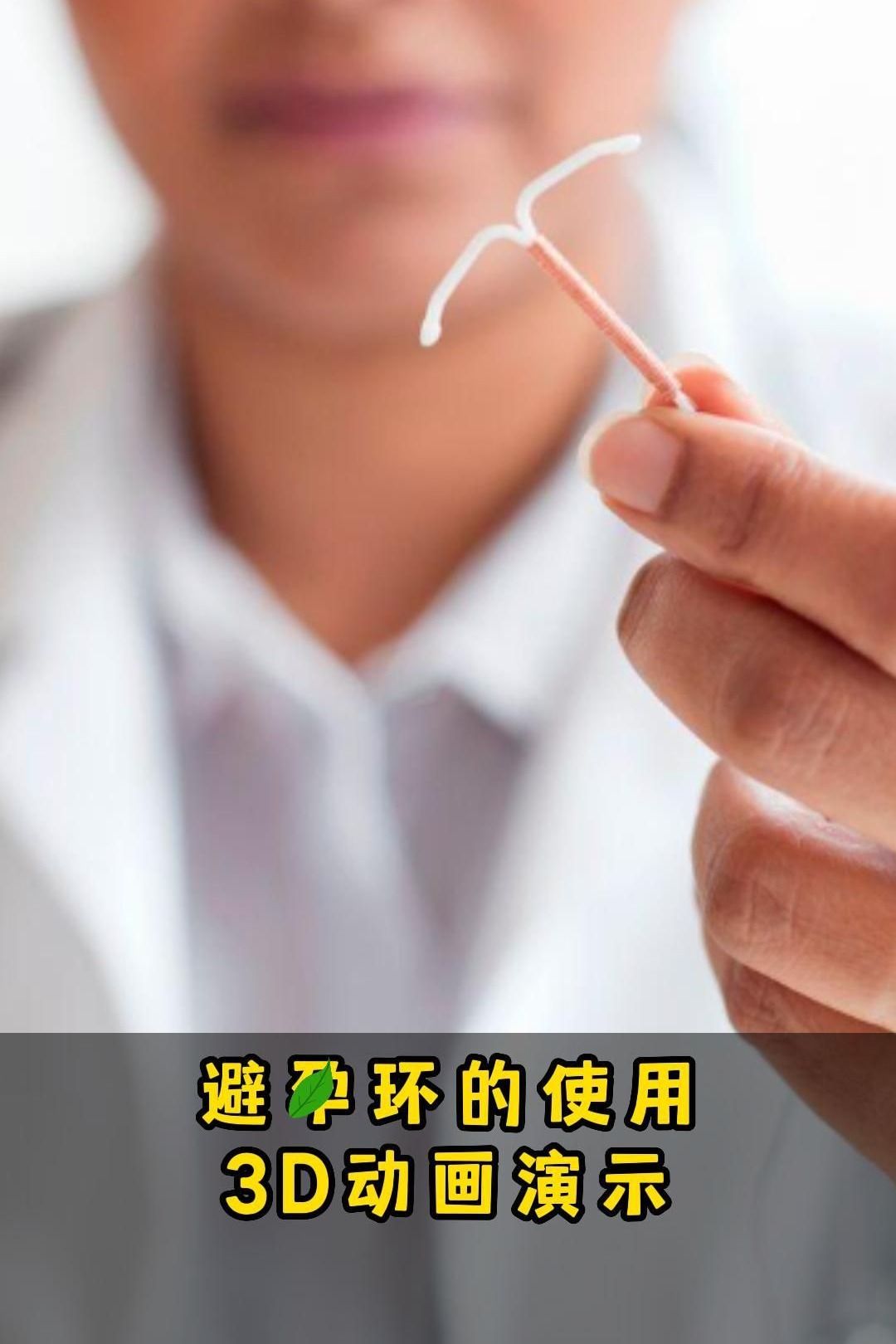 避孕环的使用3D动画演示