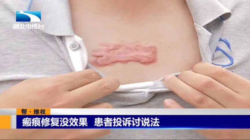 瘢痕修复没效果 患者投诉讨说法