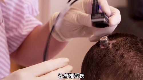 数字化神经系统,让电脑控制身体