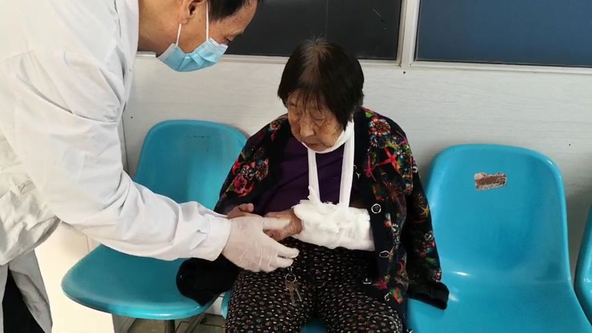 中医正骨手法治疗桡骨下端骨折