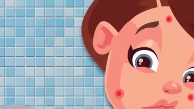 痘痘里面装的是什么呢?真的是螨虫吗?动画演示痘痘形成过程。