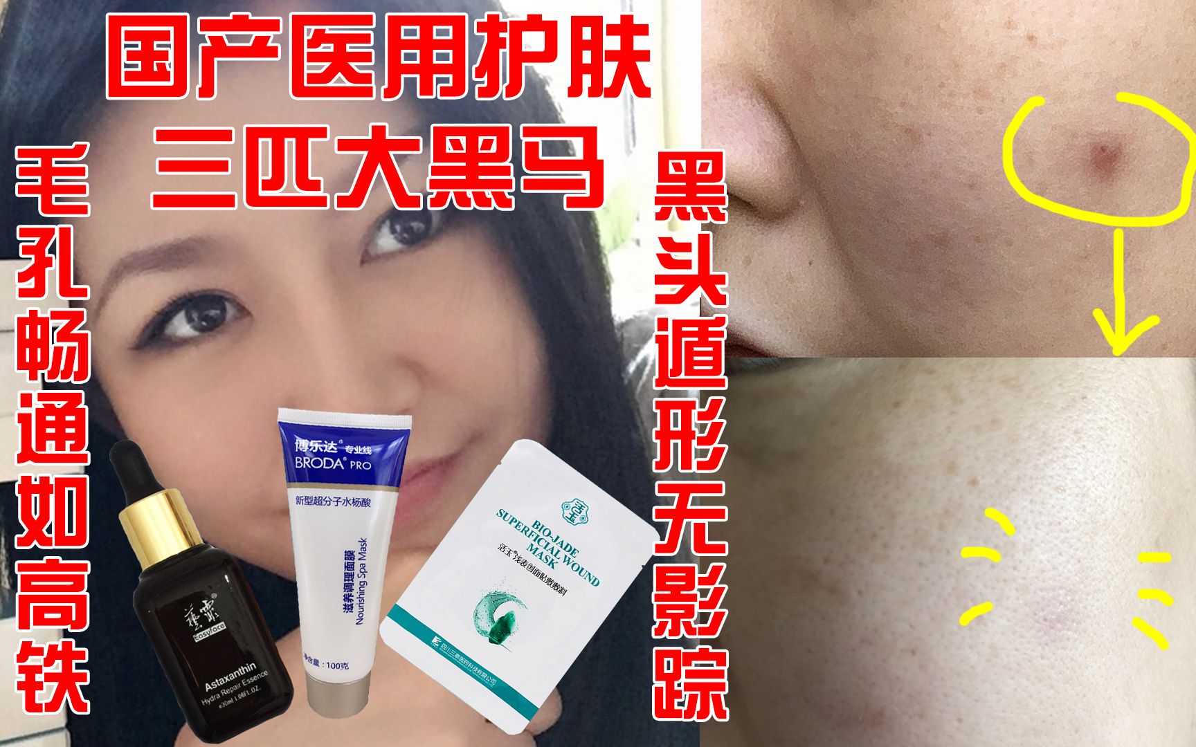 三次灭痘,七天祛印!国产医用黑马护肤品七天试用测评,真实有效,毛孔...