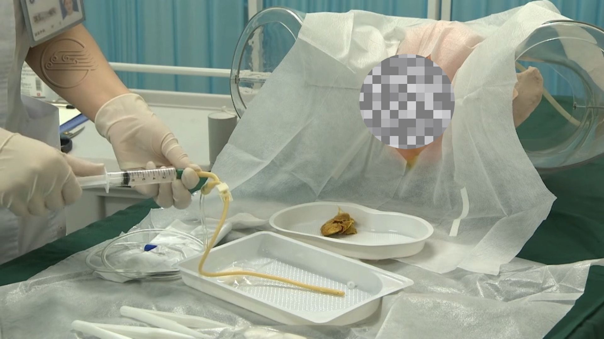 【医学实录】女性导尿术全程演示- SOP 标准化操作高清版:碘伏消毒...