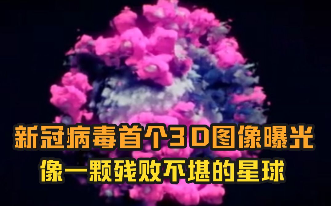 新冠病毒首个3D图像曝光:像一颗残败不堪的星球