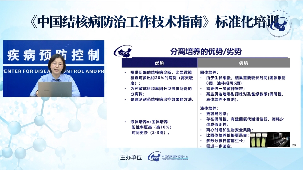 结核病细菌学检查方法