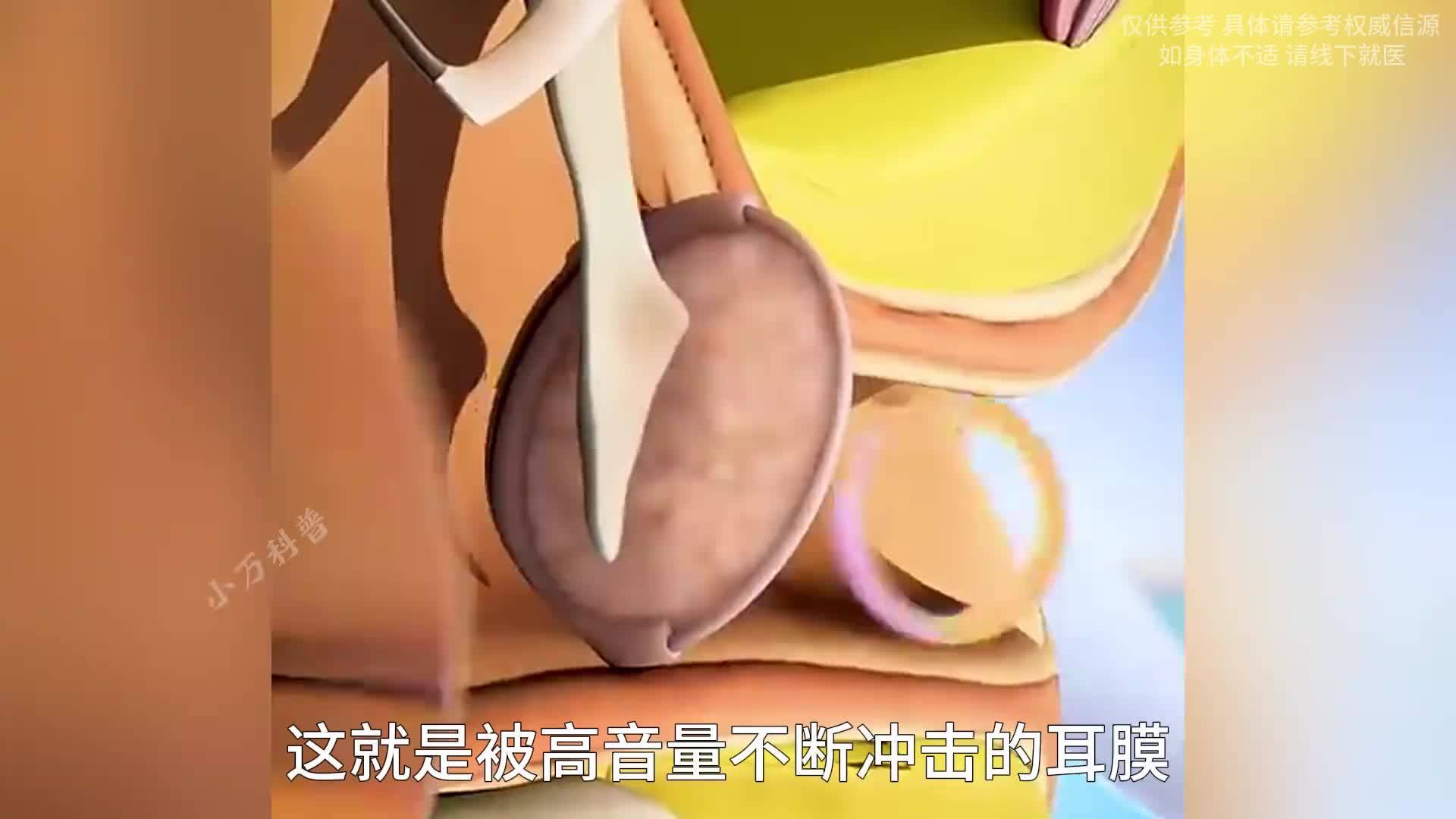 耳机音量超过这个数 = 慢性耳聋!世卫组织的警告别忽视 #科普 #戴耳机...