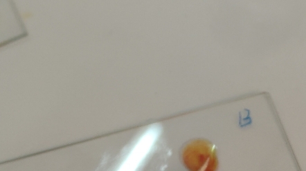 生理实验课AB血型的测定