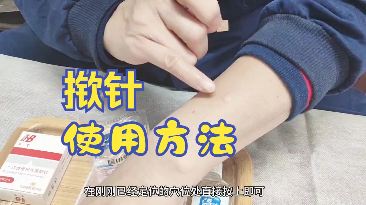 揿针使用方法