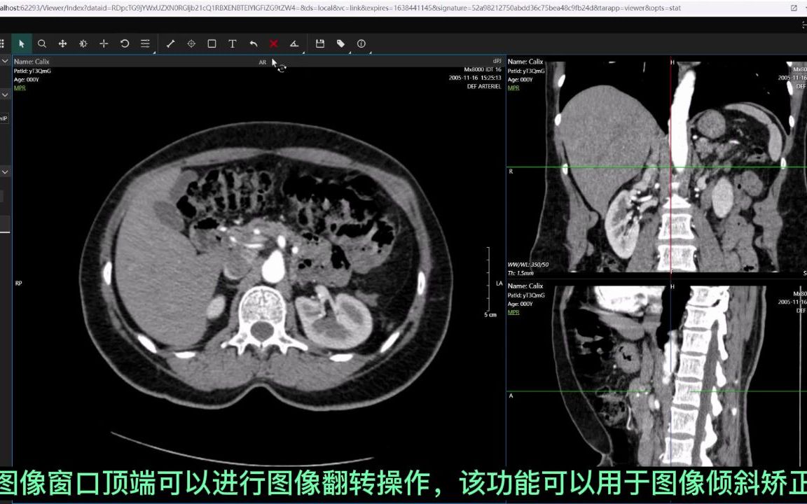 MPR viewer使用简介