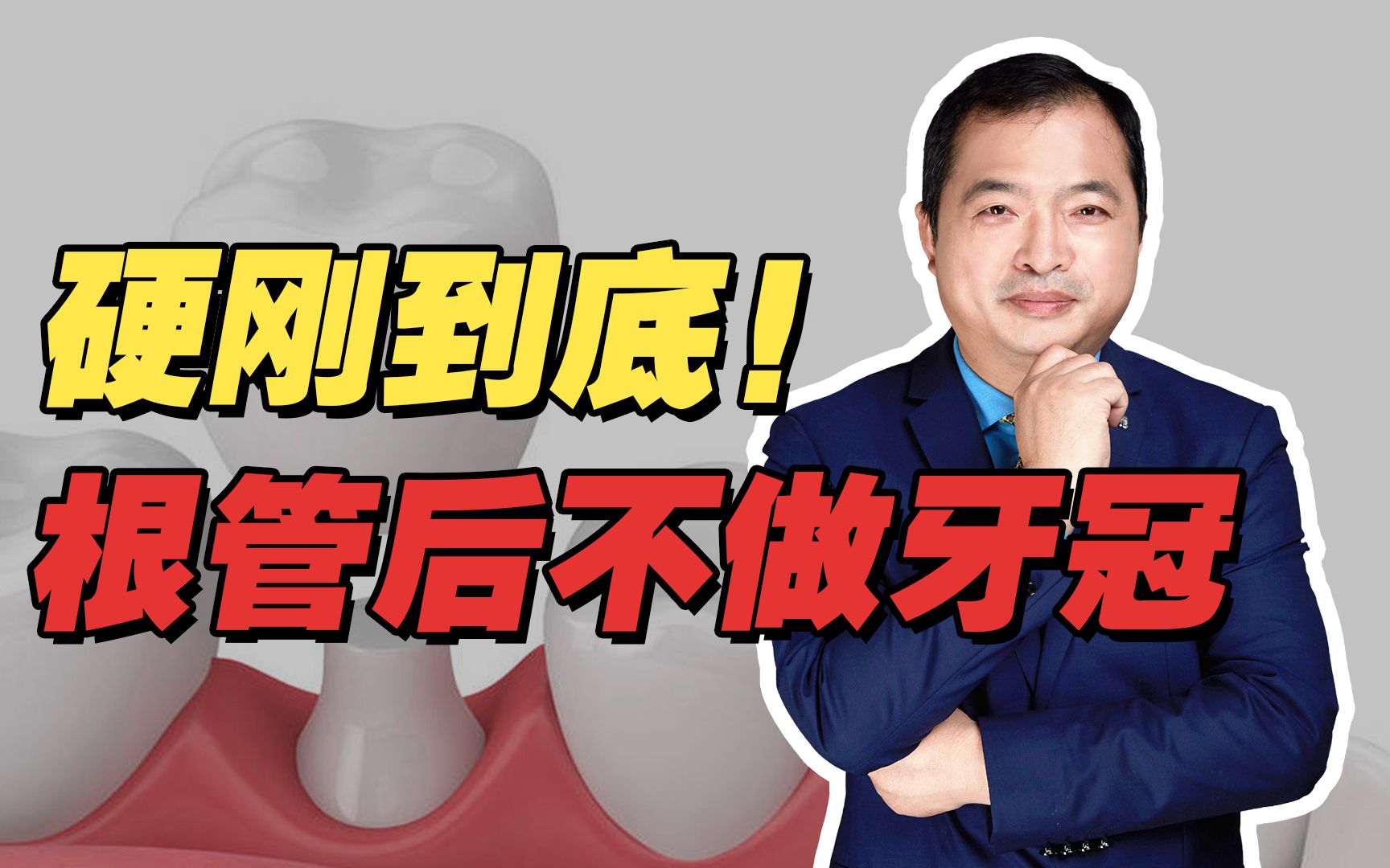 根管治疗后不做牙冠,会有影响吗?