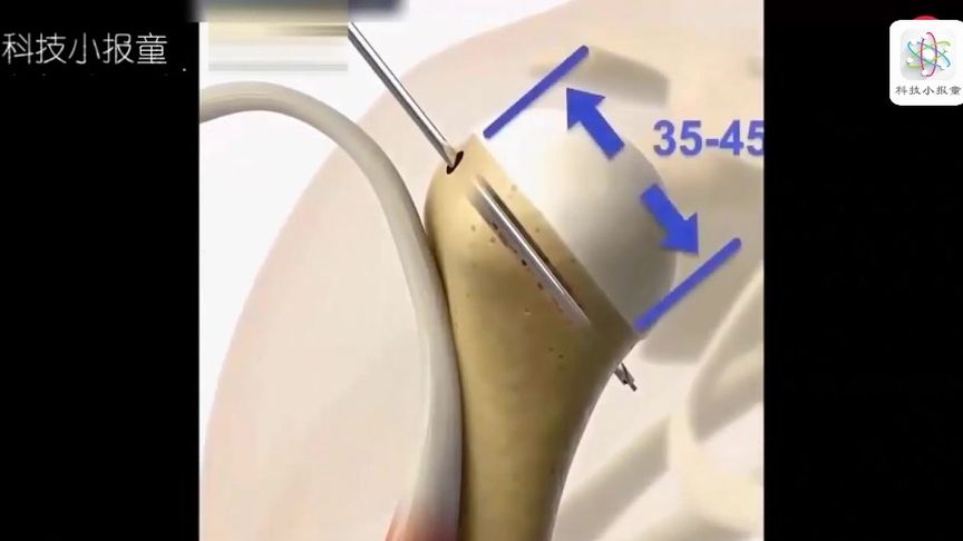 3D动画带你看清医生做手术全过程