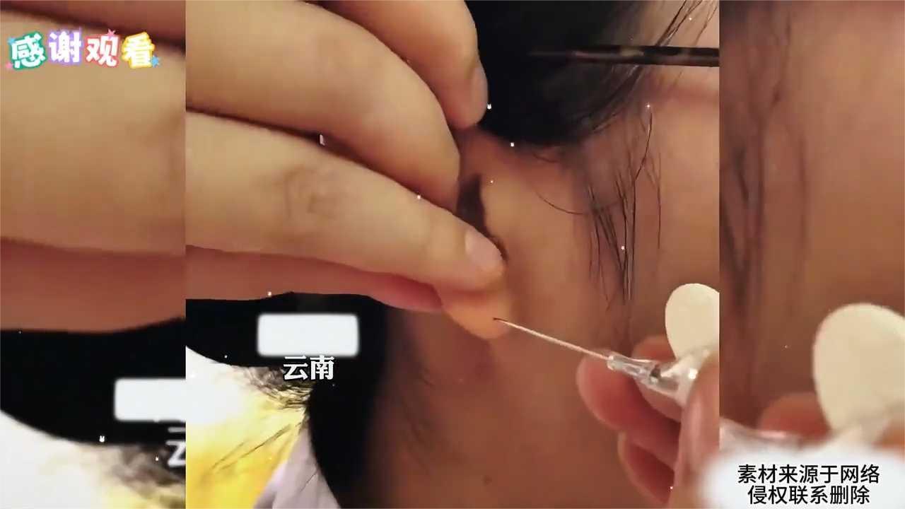 护士用滞留针打耳洞,隔着屏幕都觉得痛,网友:是个狠人!
