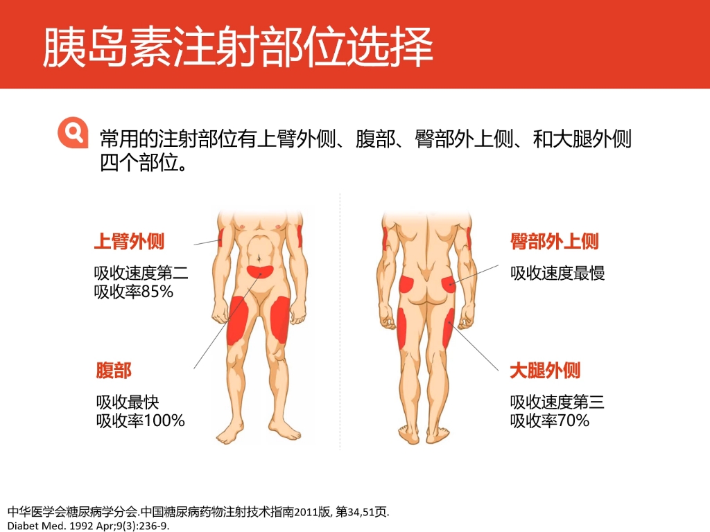 糖尿病 胰岛素规范注射篇