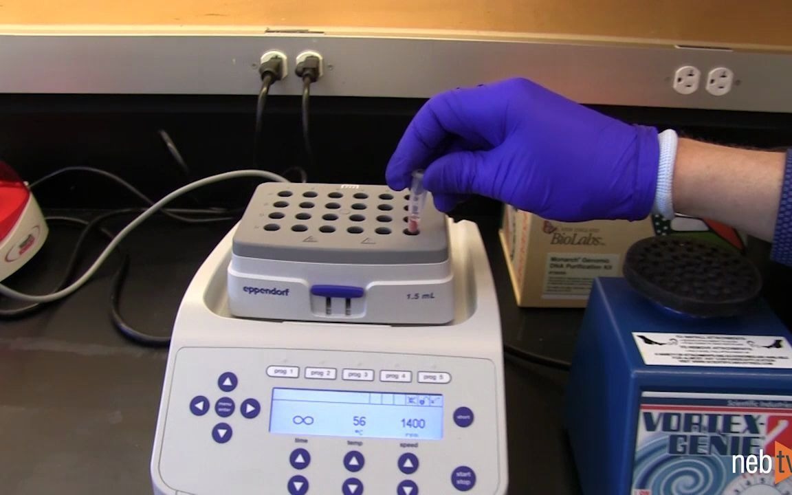 血液样品提取基因组 DNA 的实验要点