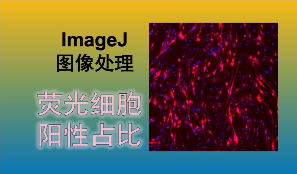 『超实用』ImageJ图像处理 - 免疫荧光之阳性细胞占比全解析