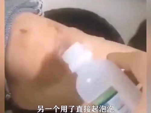 2201. 万万没想到,碘伏的消毒威力居然这么大