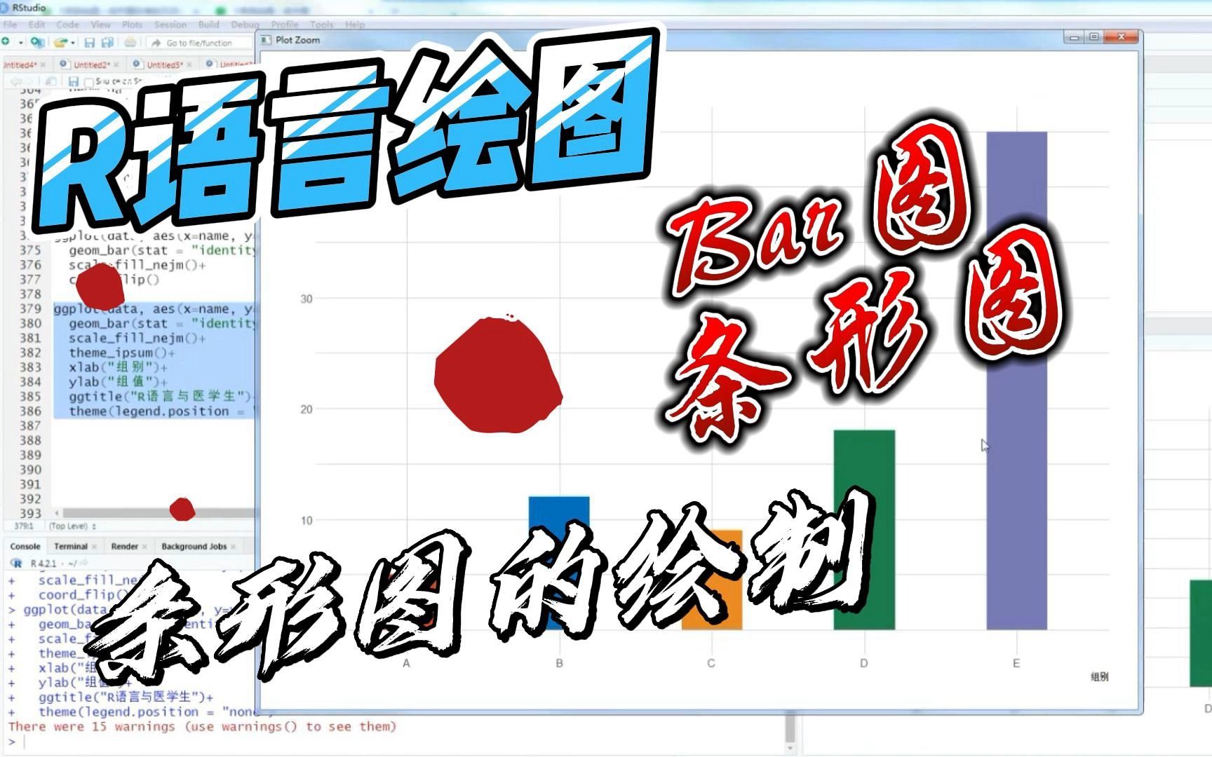 R语言绘图—条形图的绘制