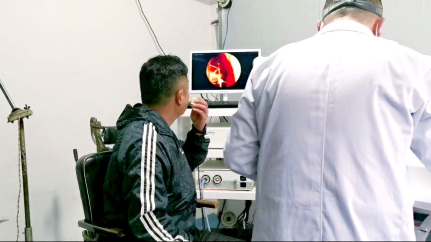 慢性鼻炎,下鼻甲肥大不用怕,杨涛医生鼻镜下消融术一次治愈。