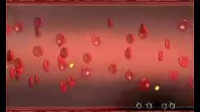 动脉粥样硬化过程