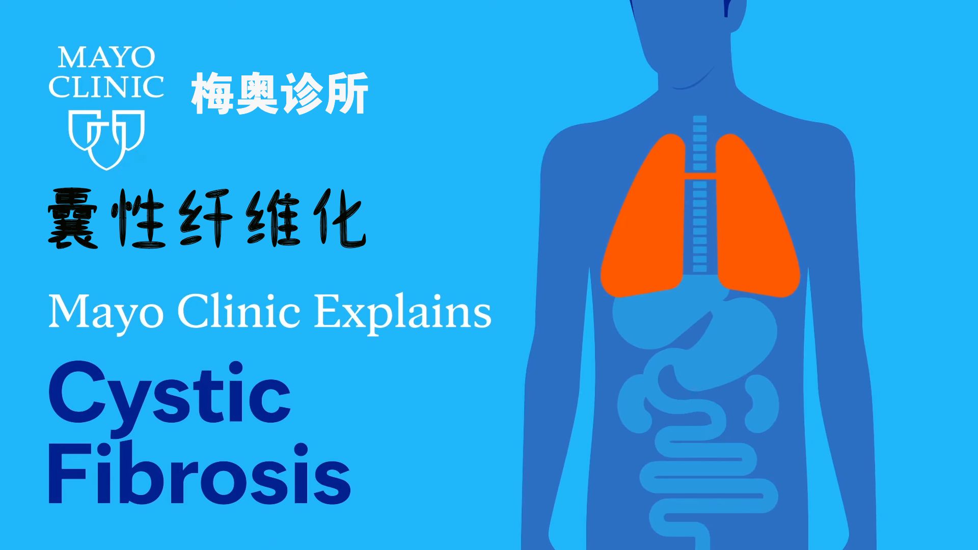 【梅奥诊所】囊性纤维化基本知识 | 医学科普
