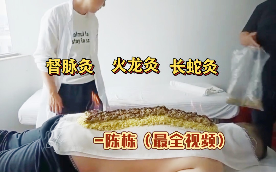 督脉灸,火龙灸,长蛇灸的操作方法-最全